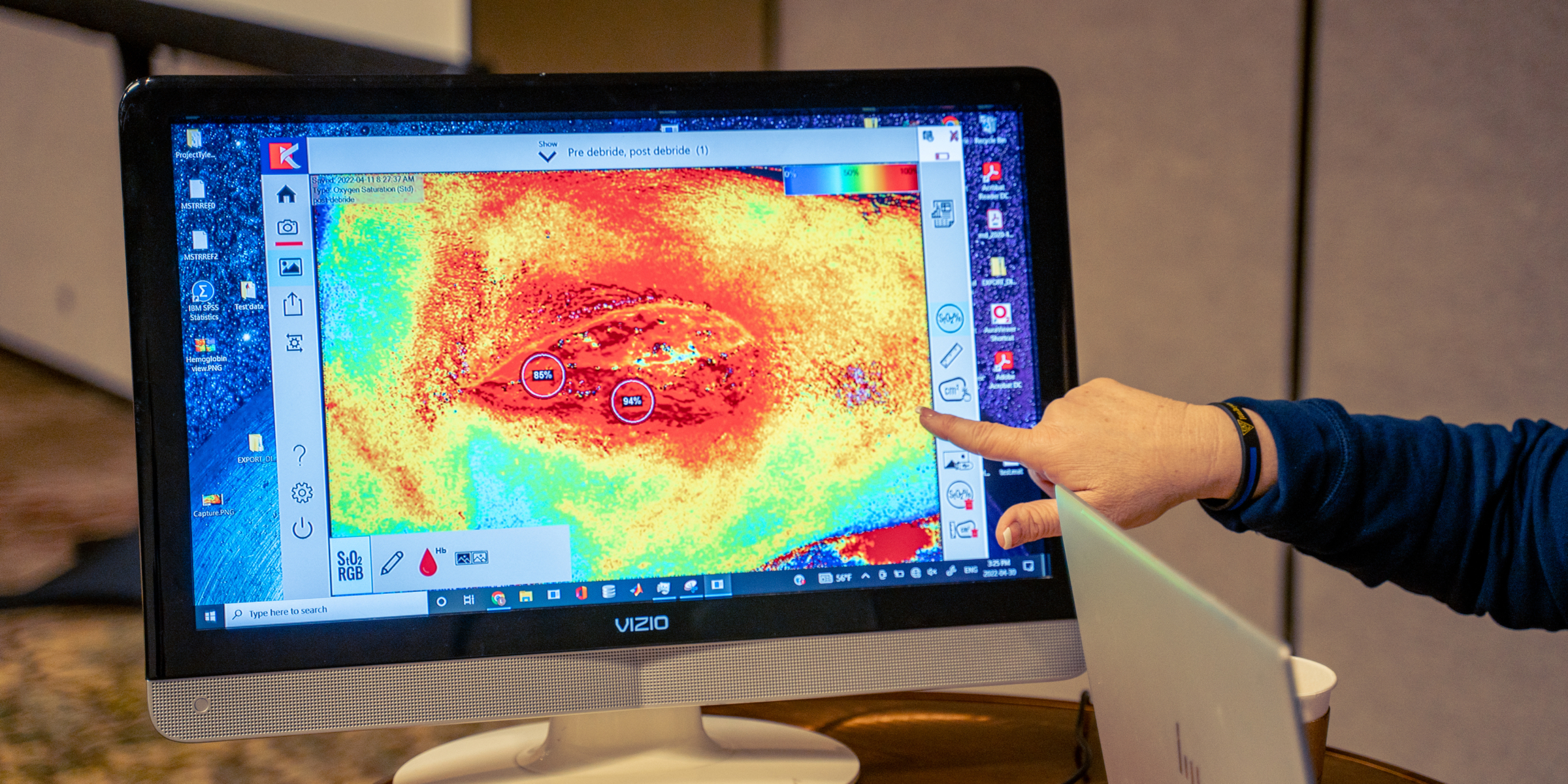 Innovation | United Wound Healing